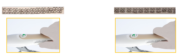 Adjustable Staple Height GST Surgical Circular Stapler